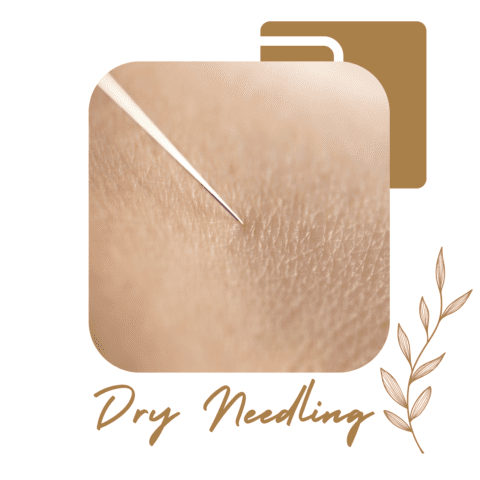 Dry Needling Explained for Beginners | On Point Natural Medicine ...